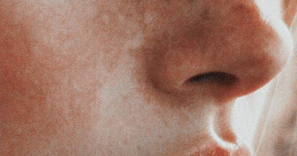 Esta es la verdadera razón por la que te salen pecas