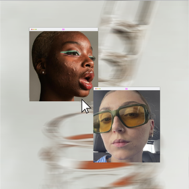 7 influencers acné positive que tienes que seguir en Instagram